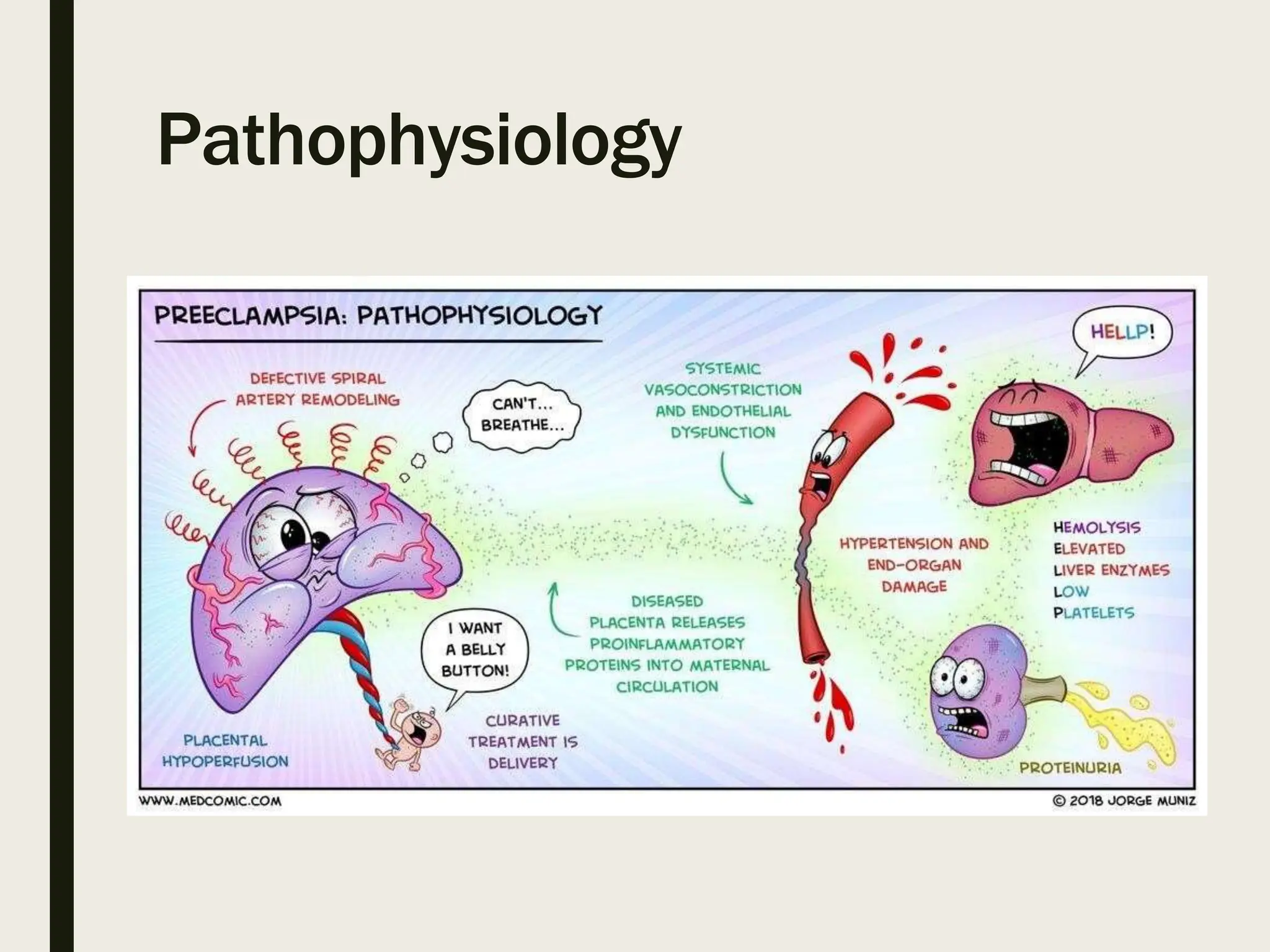 11_Eclampsia and preeclampsia real.pptxf | PPT