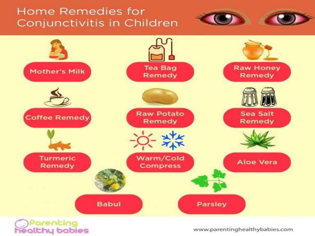 11 effective home remedies for conjunctivitis in children | PPTX