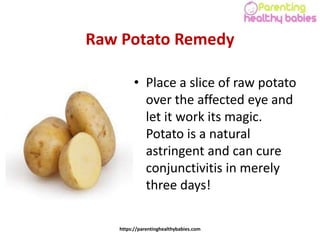 11 effective home remedies for conjunctivitis in children | PPTX