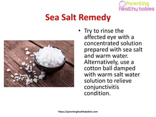 11 effective home remedies for conjunctivitis in children | PPTX