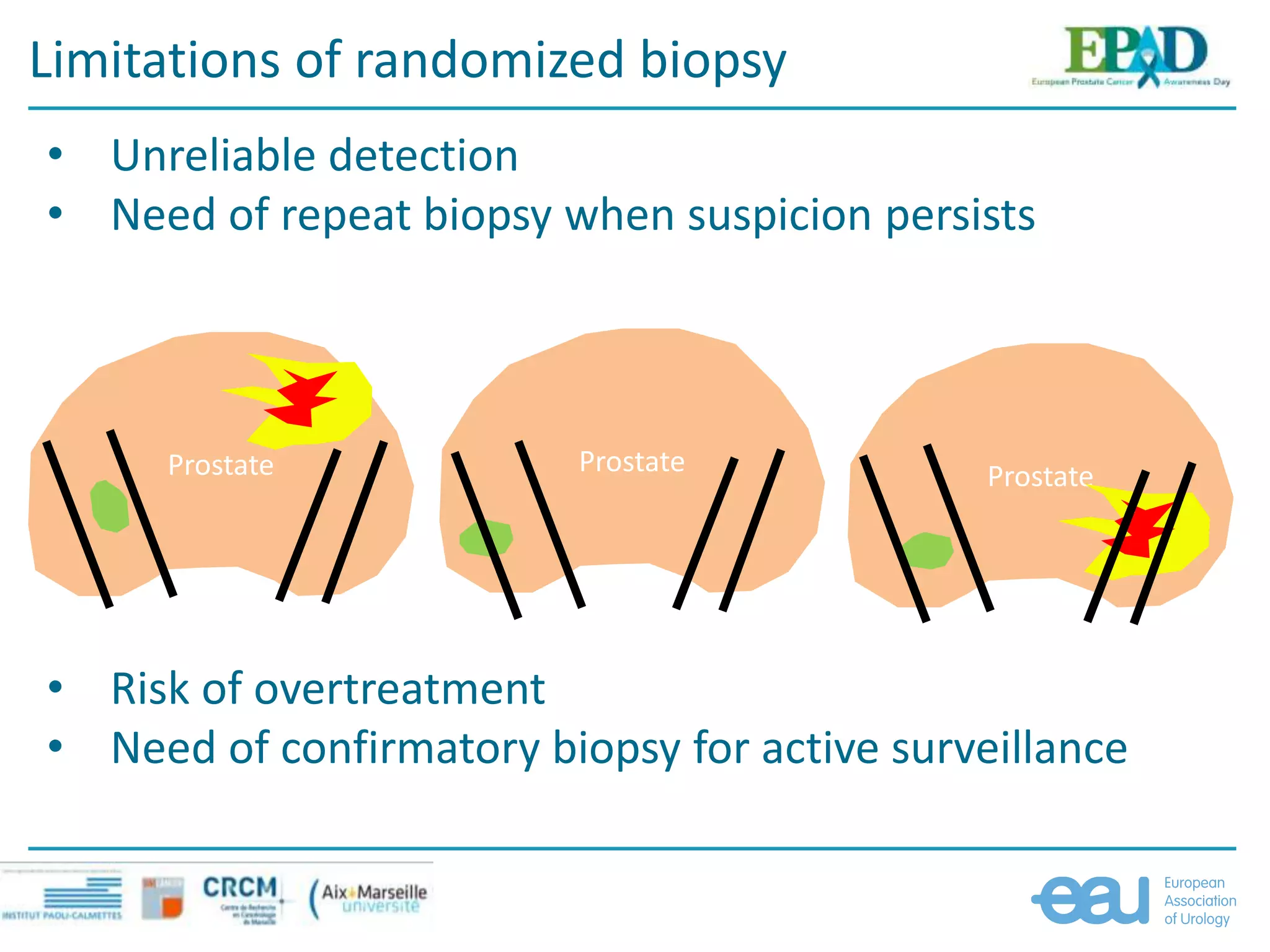 EPAD 2017 - Jochen Walz | PPTX