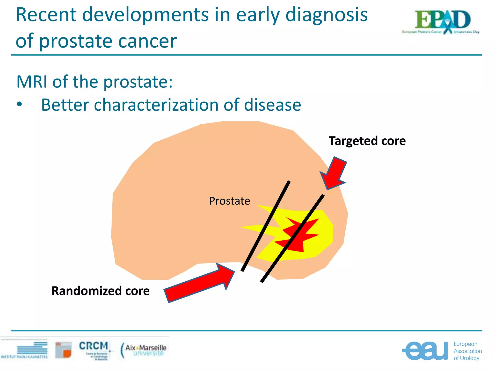 EPAD 2017 - Jochen Walz | PPTX