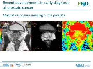EPAD 2017 - Jochen Walz | PPTX