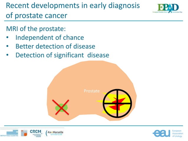 EPAD 2017 - Jochen Walz | PPTX