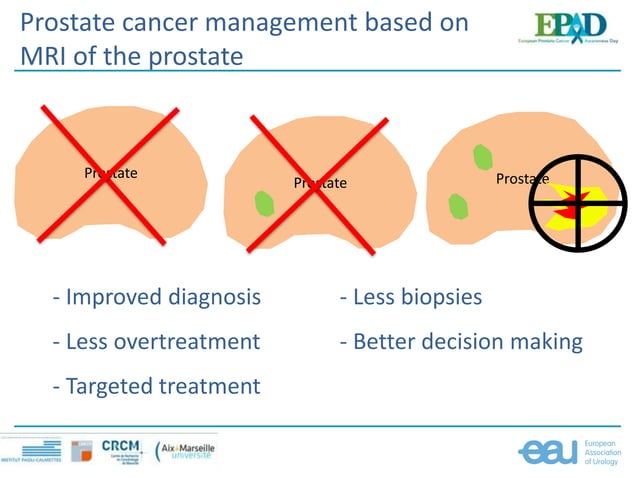 EPAD 2017 - Jochen Walz | PPTX