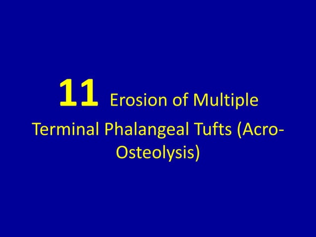 11 erosion of multiple terminal phalangeal tufts (ACROOSTEOLYSIS ...