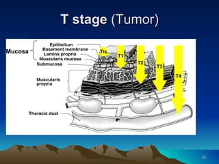 11 esophageal cancer | PPT