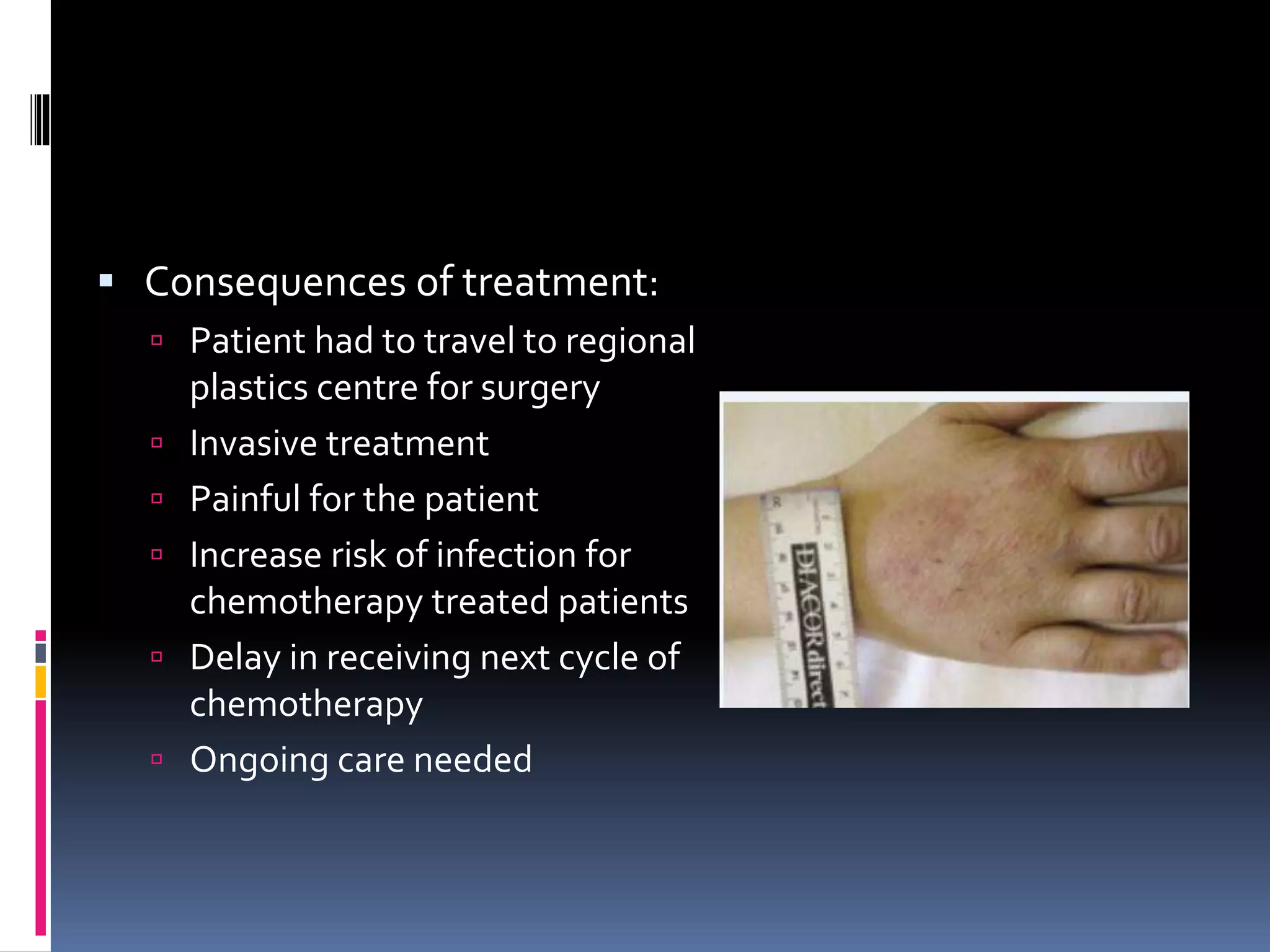 11 Extravasation.ppt