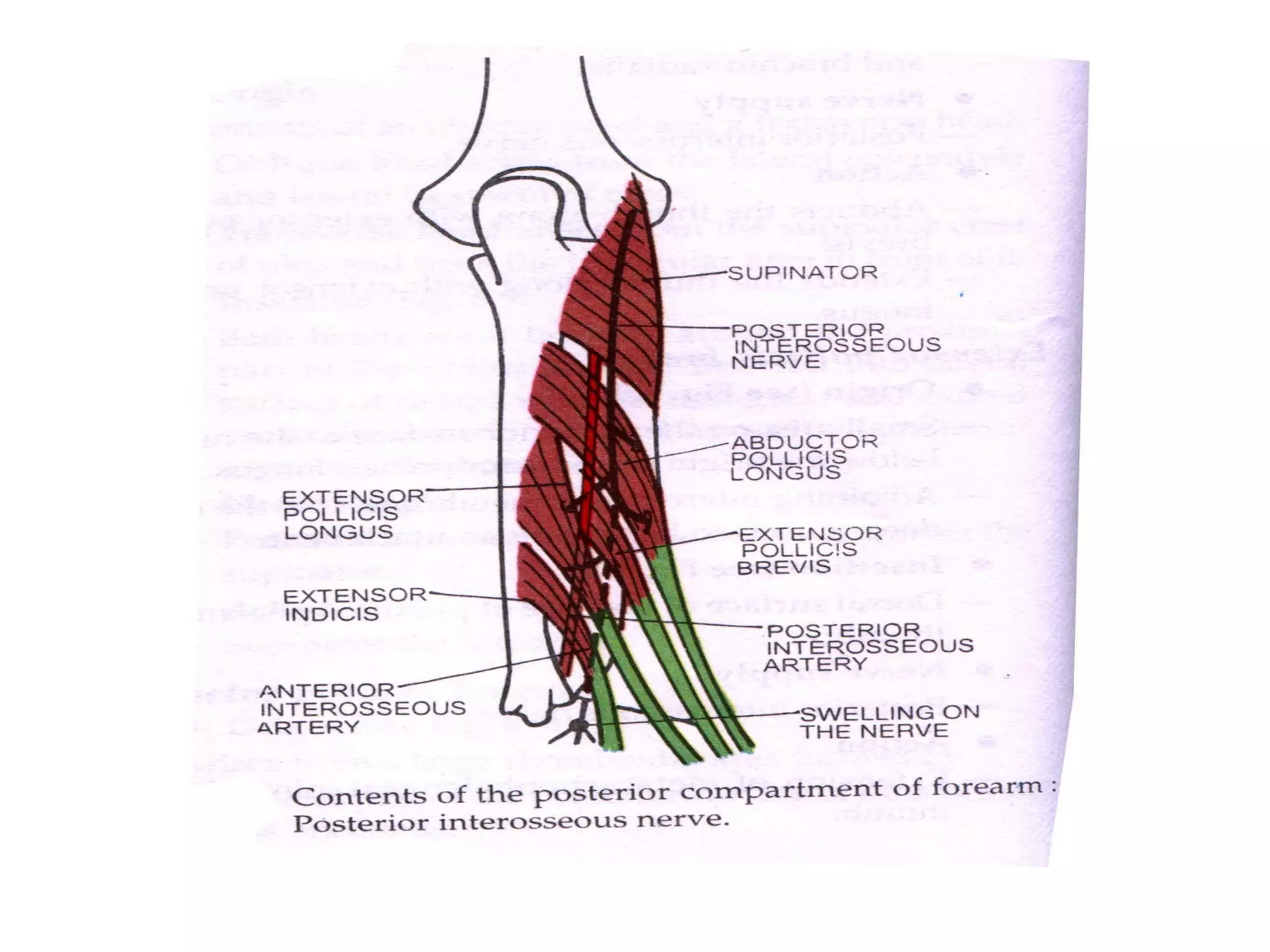 forearm extensor compartment | PPT