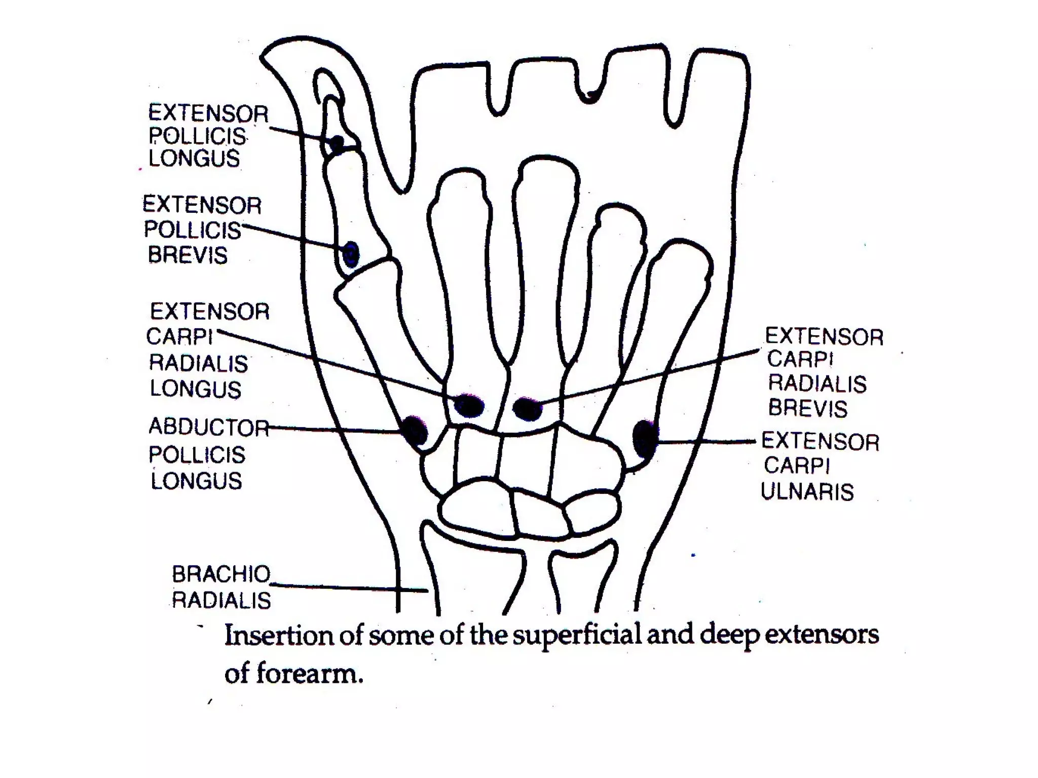 forearm extensor compartment | PPT