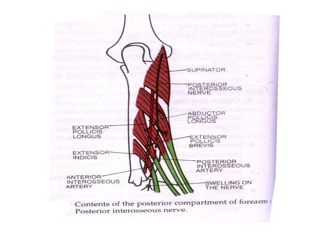 forearm extensor compartment | PPT