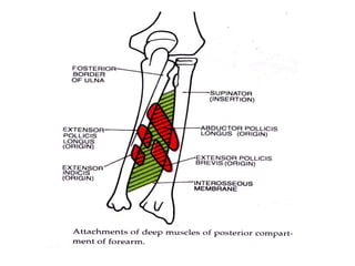 forearm extensor compartment | PPT