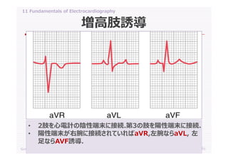 11 fundamentals of electrocardiography