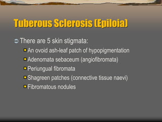 genetic diseases | PPT