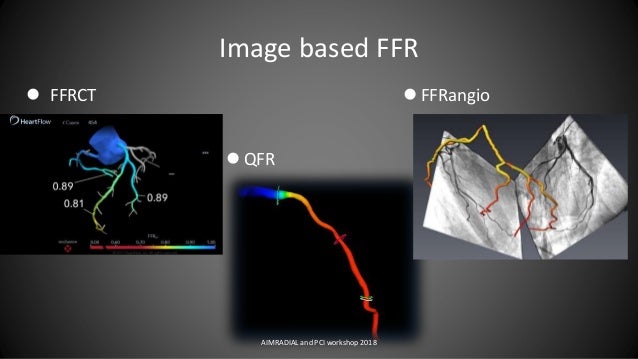 PCI & AimRadial 2018 | Image based FFR vduring coronary angiography