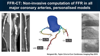 PCI & AimRadial 2018 | FFR-CT - Colin Berry | PPTX | Heart and ...