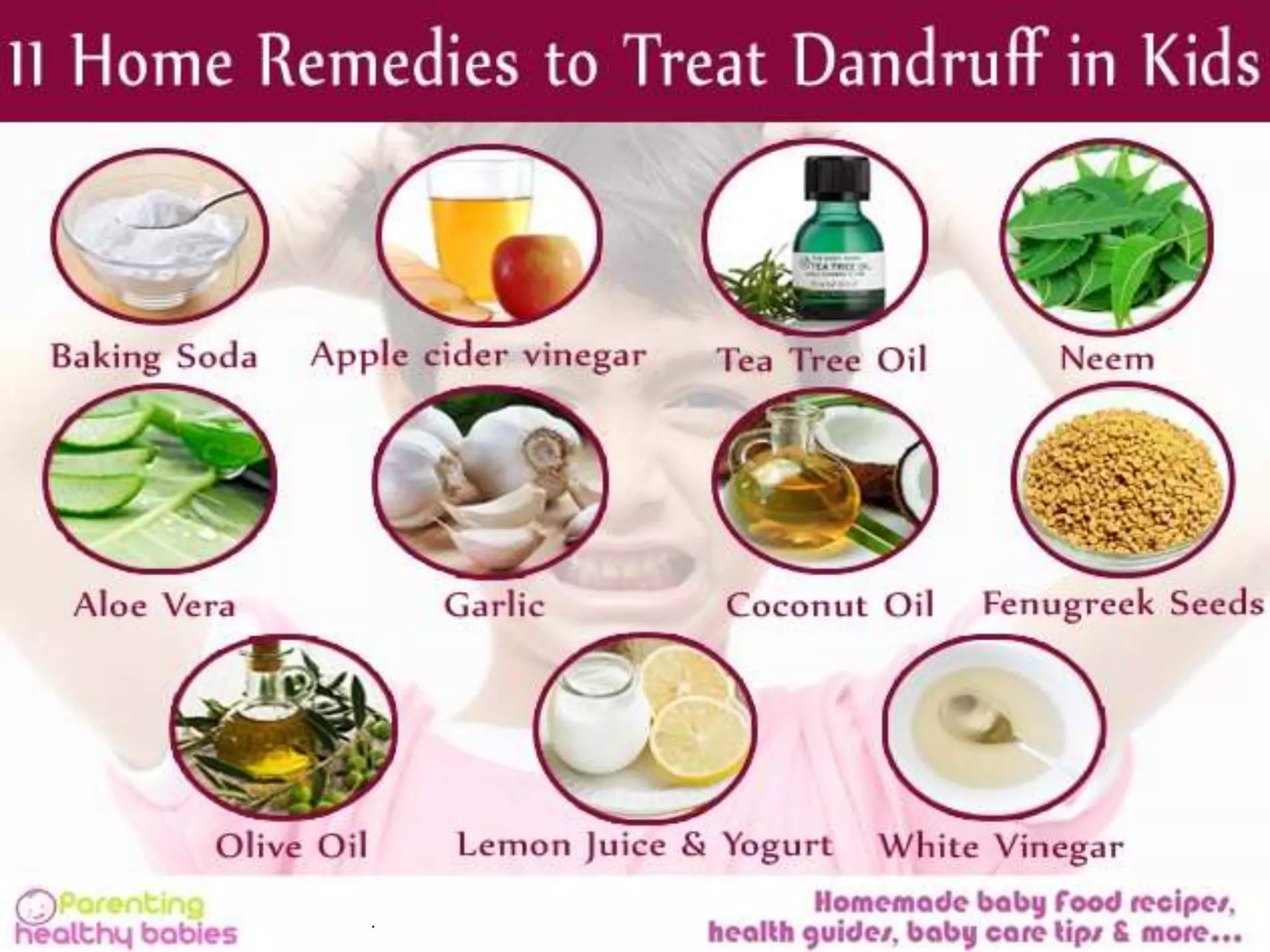 11 home remedies to treat dandruff in kids | PPT | Free Download