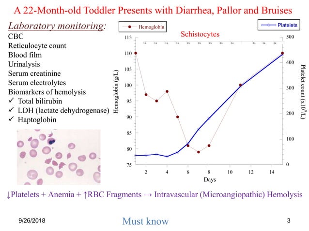 HUS.ppt | Blood Disorders | Diseases and Conditions