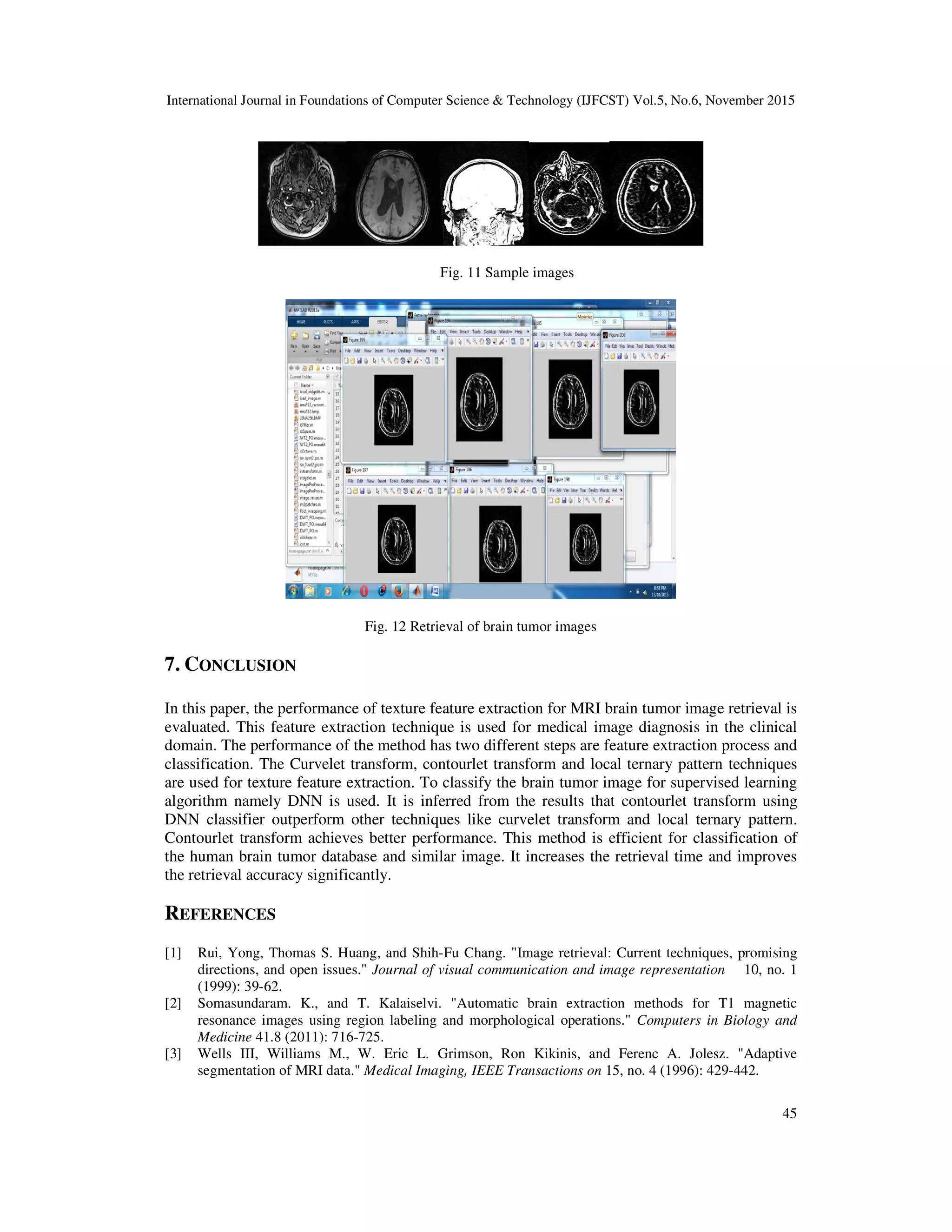 PERFORMANCE ANALYSIS OF TEXTURE IMAGE RETRIEVAL FOR CURVELET, CONTOURLET TRANSFORM AND LOCAL ...