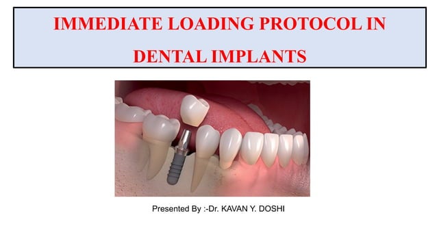 Immediate implant loading protocols.pptx