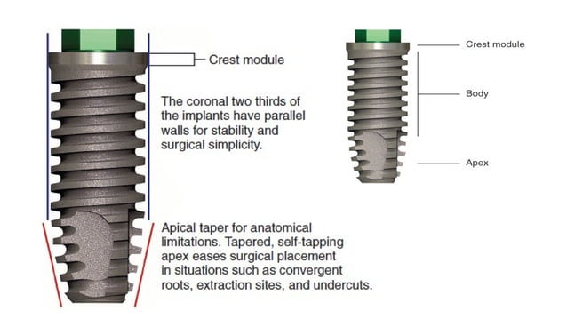 Immediate implant loading protocols.pptx