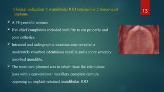 11) implant supported overdenture.pptx aa | PPTX