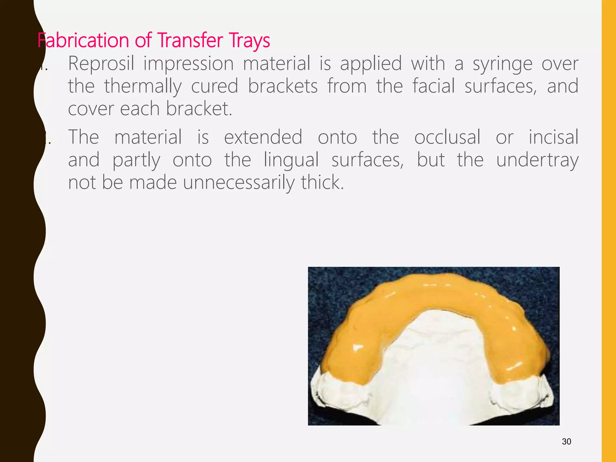 indirect bonding | PPTX