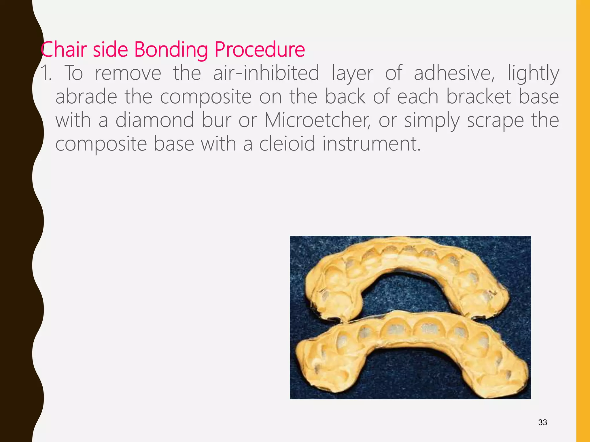 indirect bonding | PPTX