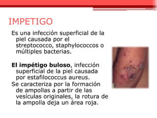 11 infecciones e infestaciones de la piel | PPTX