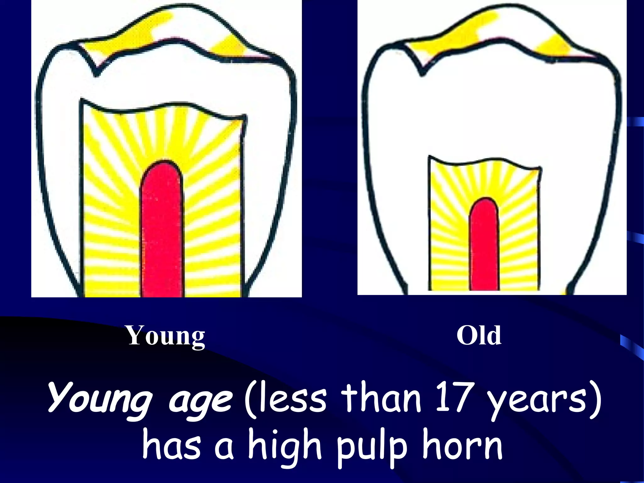 introduction to removable partial denture | PPT