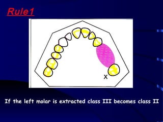 introduction to removable partial denture