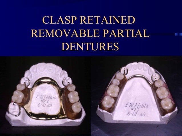 introduction to removable partial denture