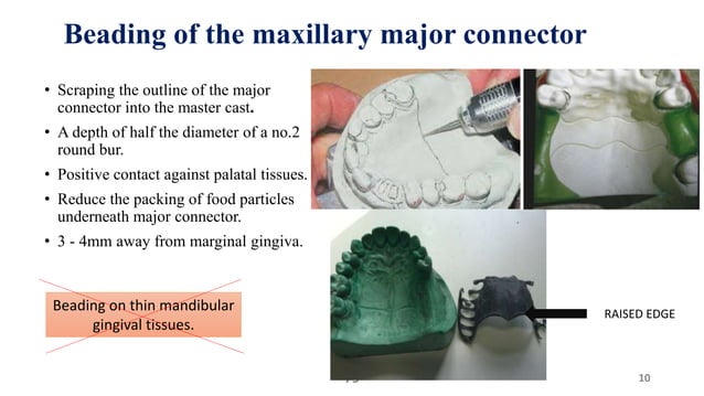 Laboratory procedures in rpd- Kelly | PPTX | Oral care | Personal Care