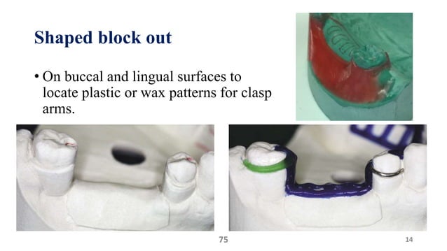 Laboratory procedures in rpd- Kelly | PPTX | Oral care | Personal Care