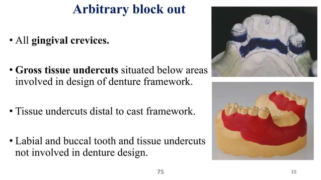 Laboratory procedures in rpd- Kelly | PPTX | Oral care | Personal Care