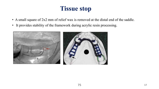 Laboratory procedures in rpd- Kelly | PPTX | Oral care | Personal Care