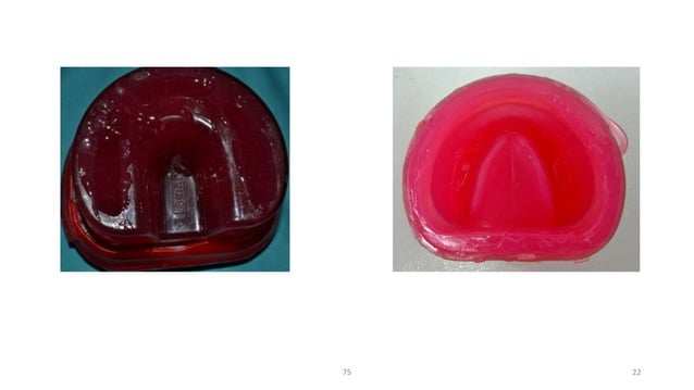 Laboratory procedures in rpd- Kelly | PPTX | Oral care | Personal Care