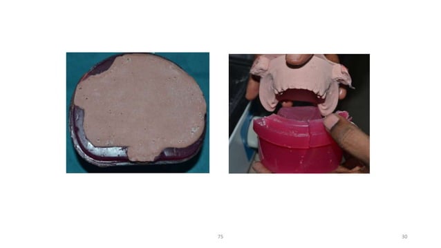 Laboratory procedures in rpd- Kelly | PPTX | Oral care | Personal Care