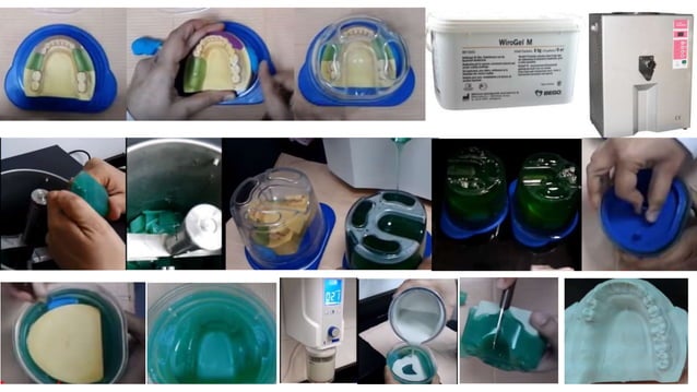 Laboratory procedures in rpd- Kelly | PPTX | Oral care | Personal Care