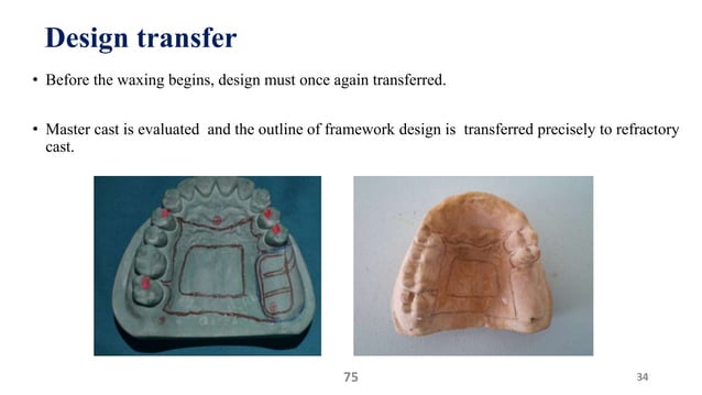 Laboratory procedures in rpd- Kelly | PPTX | Oral care | Personal Care