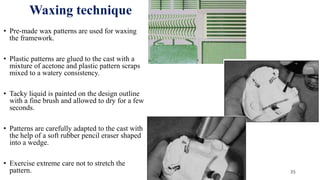 Laboratory procedures in rpd- Kelly | PPTX