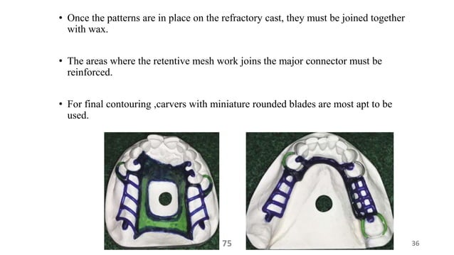 Laboratory procedures in rpd- Kelly | PPTX | Oral care | Personal Care
