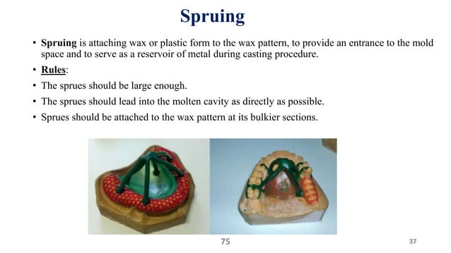 Laboratory procedures in rpd- Kelly | PPTX | Oral care | Personal Care