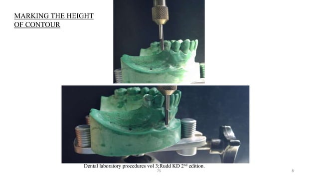 Laboratory procedures in rpd- Kelly | PPTX | Oral care | Personal Care