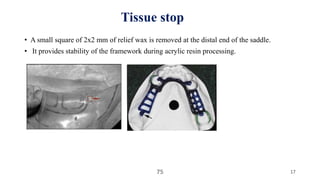 Laboratory procedures in rpd- Kelly | PPT