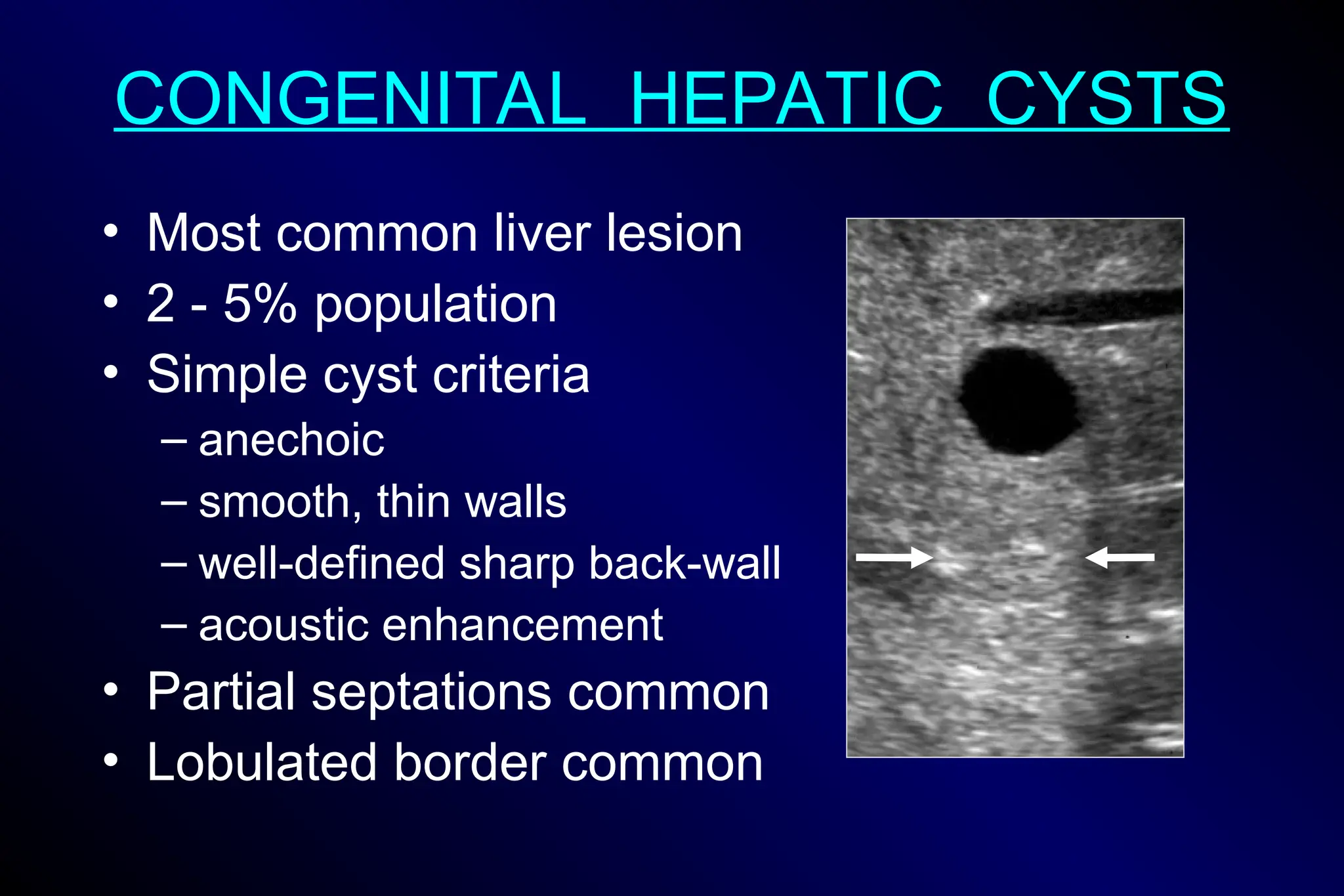 ULTRASOUND LIVER CYSTIC MASSES PPT PRESENTATION | PPT