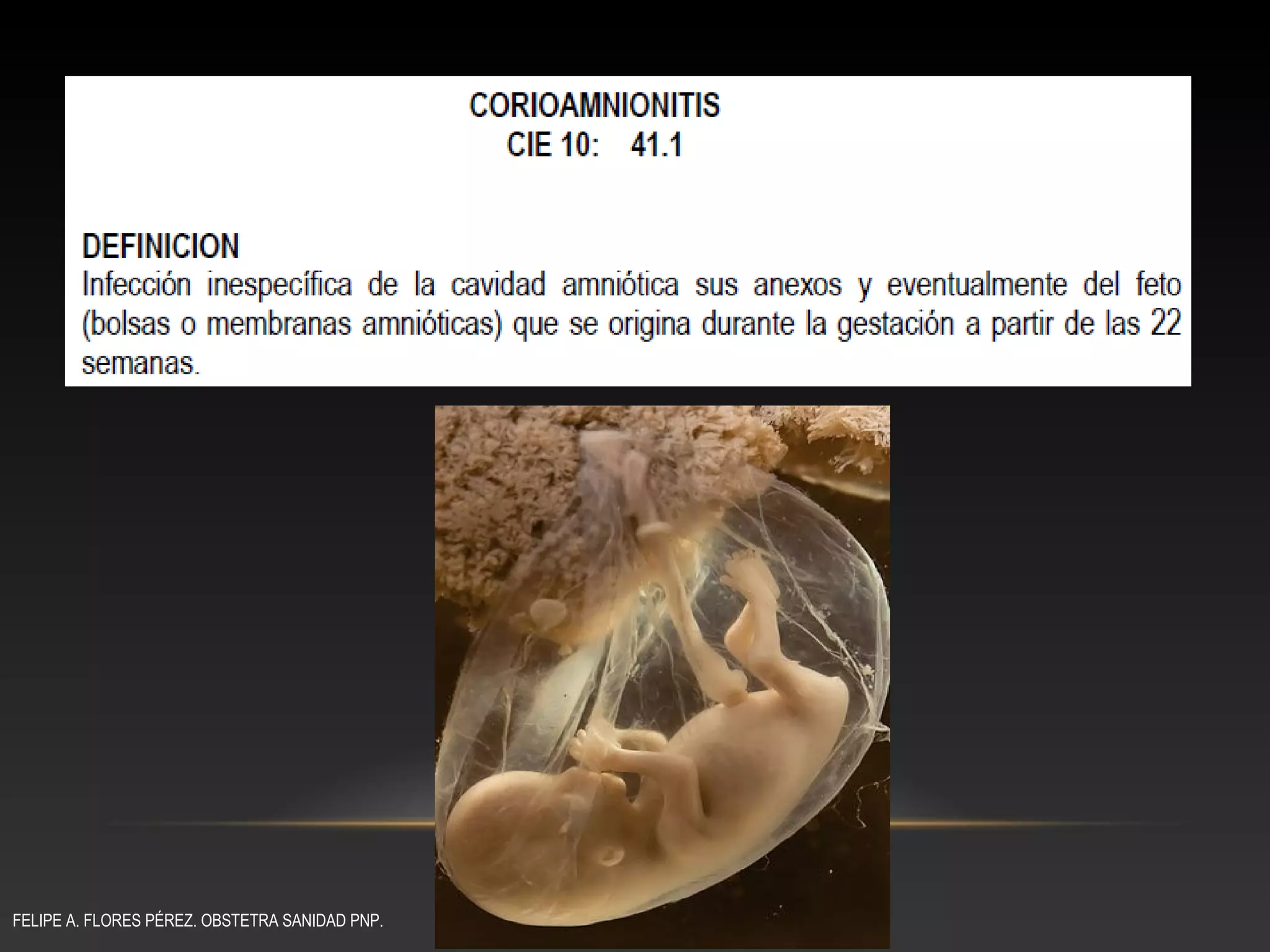 Maduración pulmonar fetal. Corioamnionitis. Shock septico | PPT