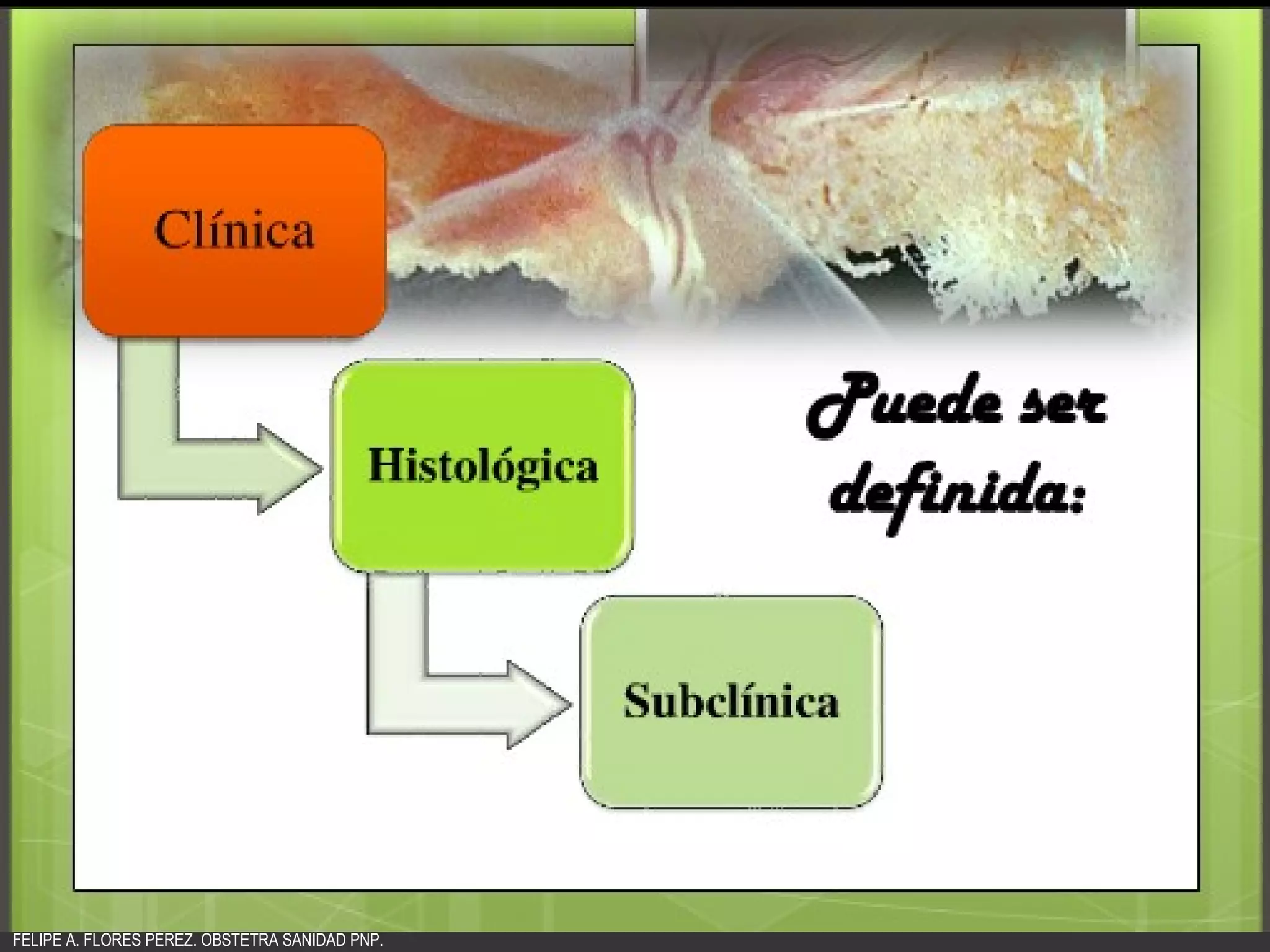 Maduración pulmonar fetal. Corioamnionitis. Shock septico | PPT