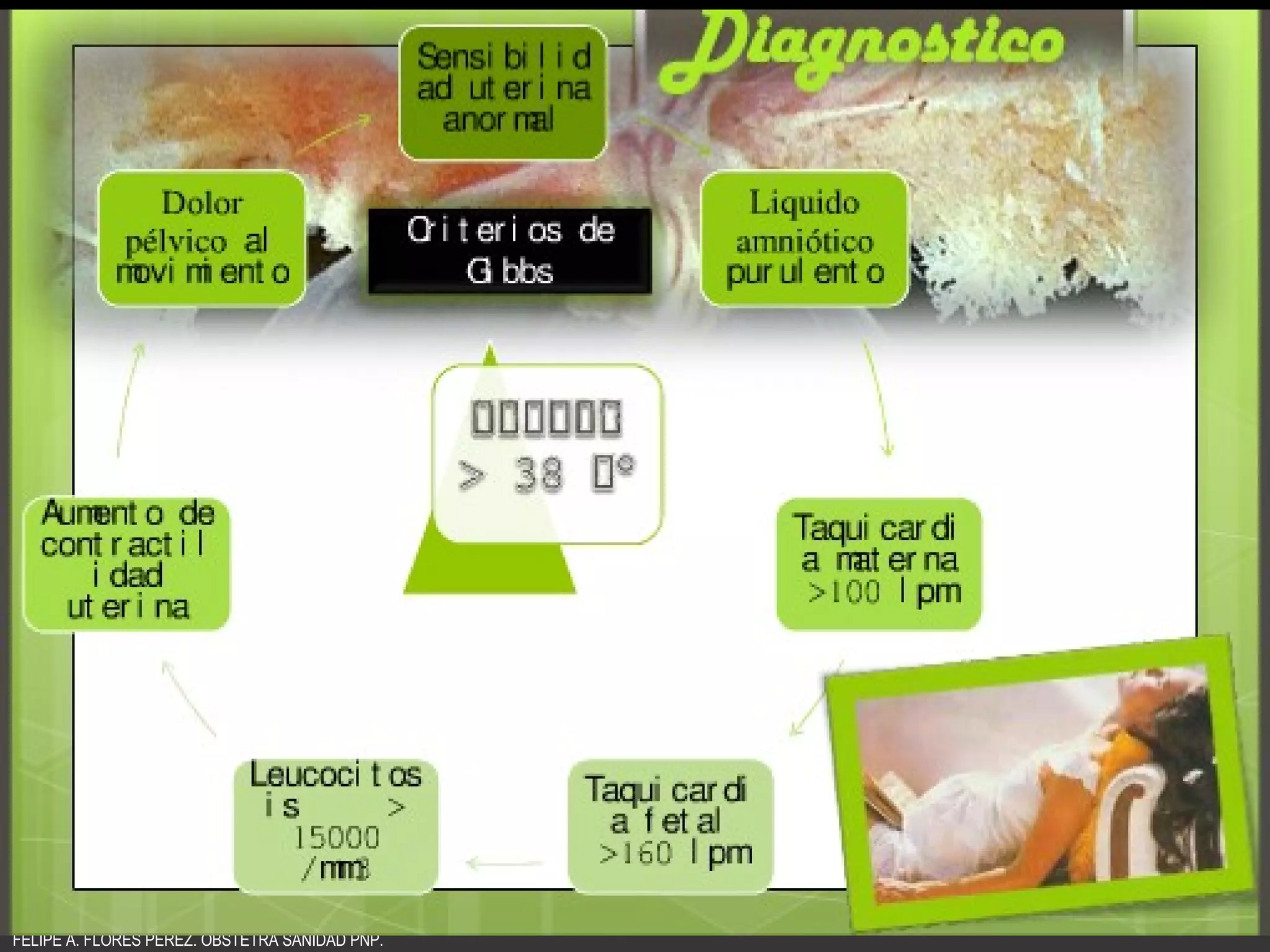 Maduración pulmonar fetal. Corioamnionitis. Shock septico | PPT