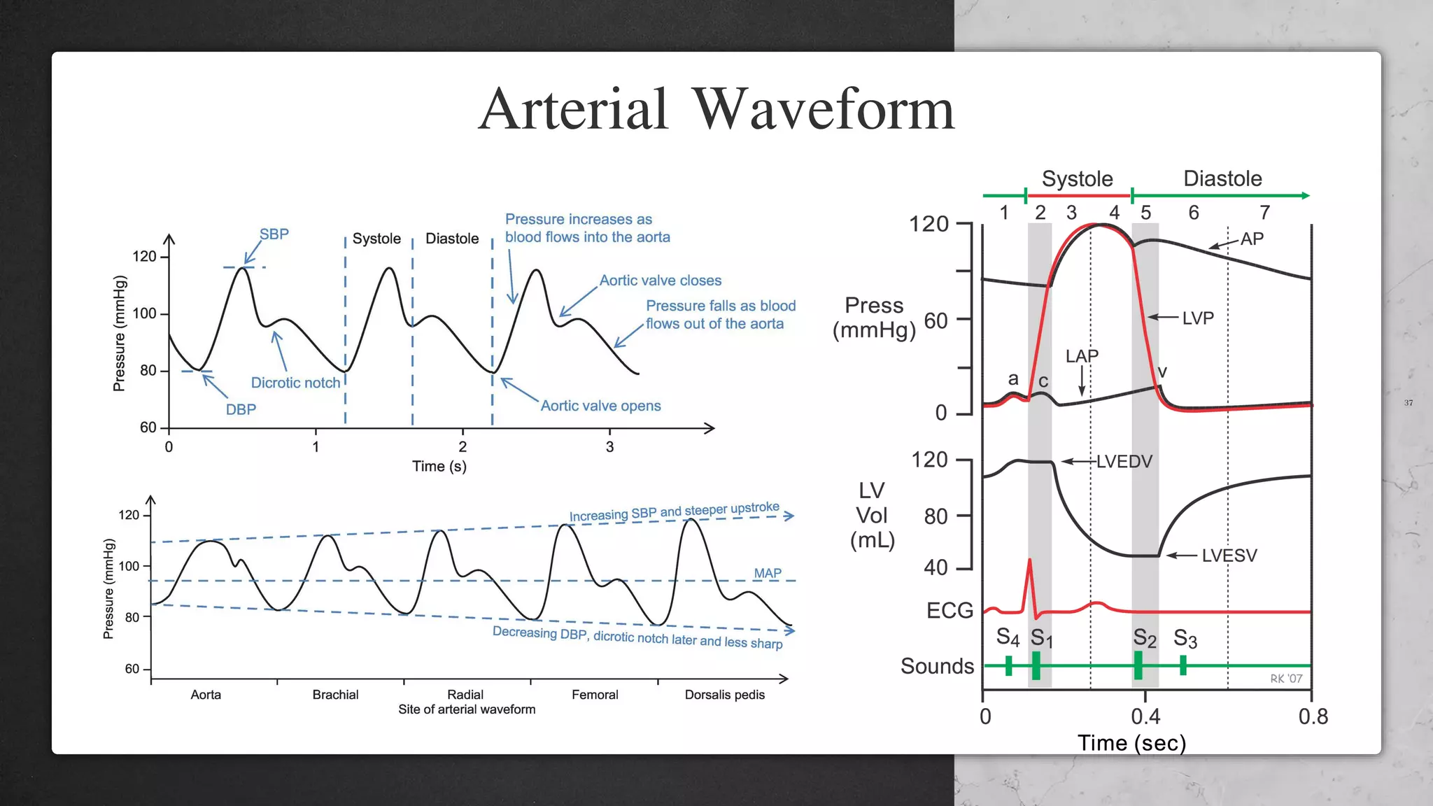 11_Management Post operative Low Cardiac Output Syndrome.pdf